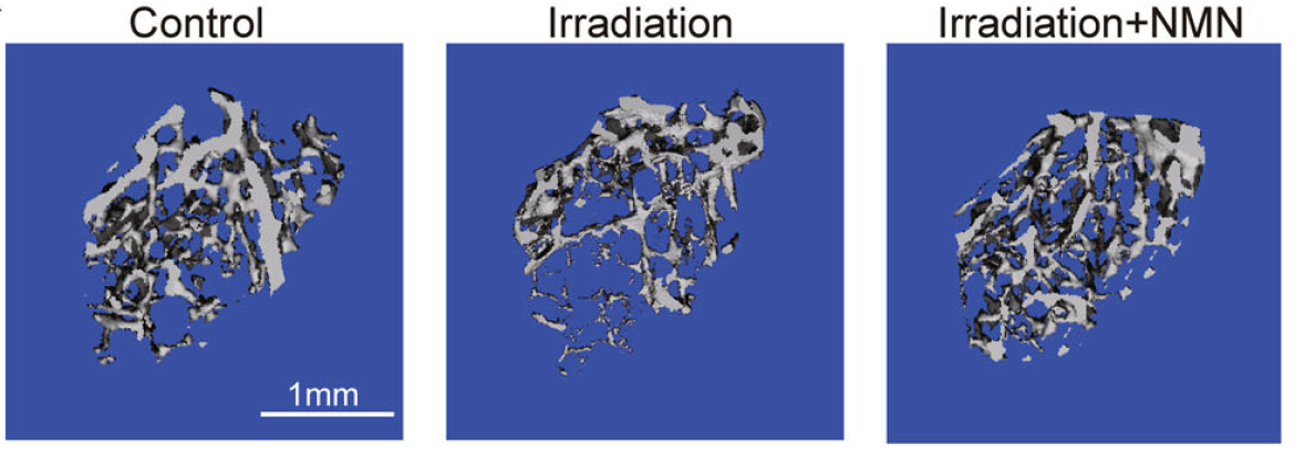 How NMN Influences Bone Marrow Stem Cell Transformation