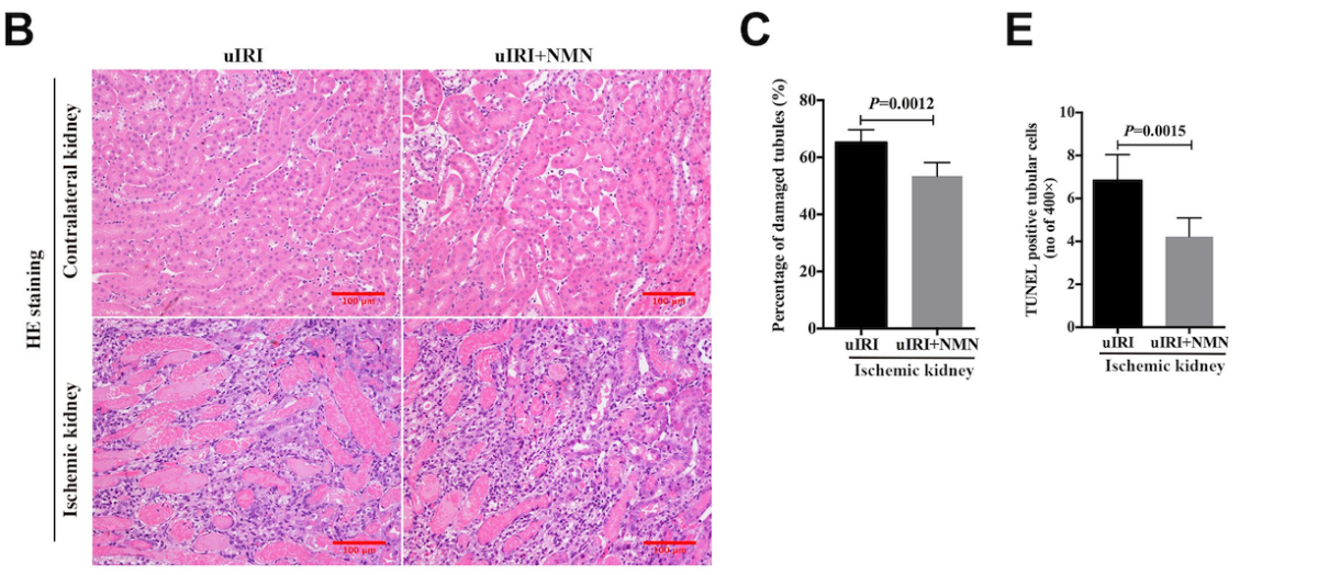 NMN Protects Against DNA Damage-Related Kidney Scarring