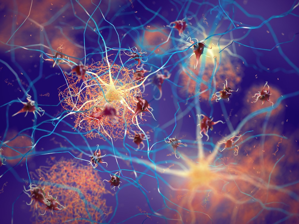 Berberine Improves Spatial Memory in a Mouse Model of Alzheimer’s
