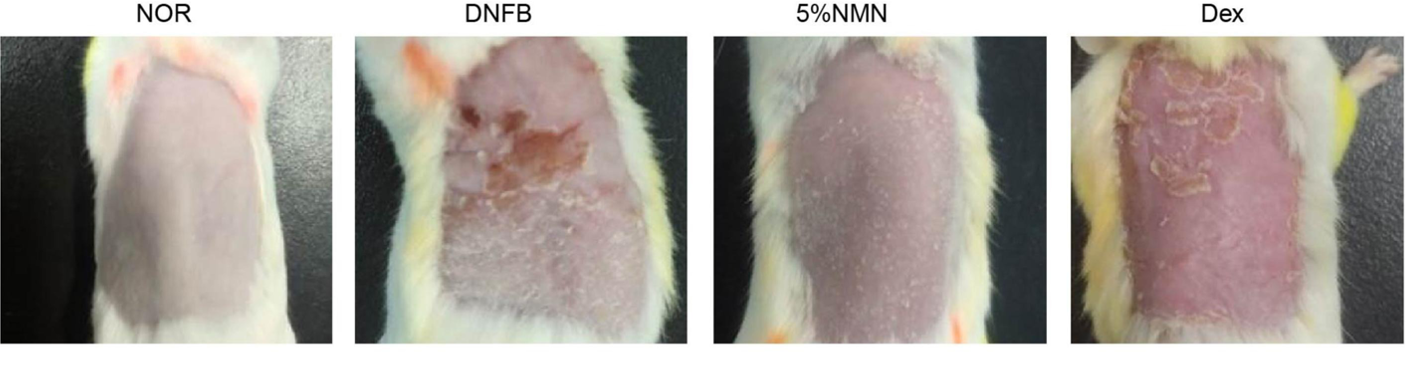 Researchers Show Topical NMN Relieves Skin Inflammation