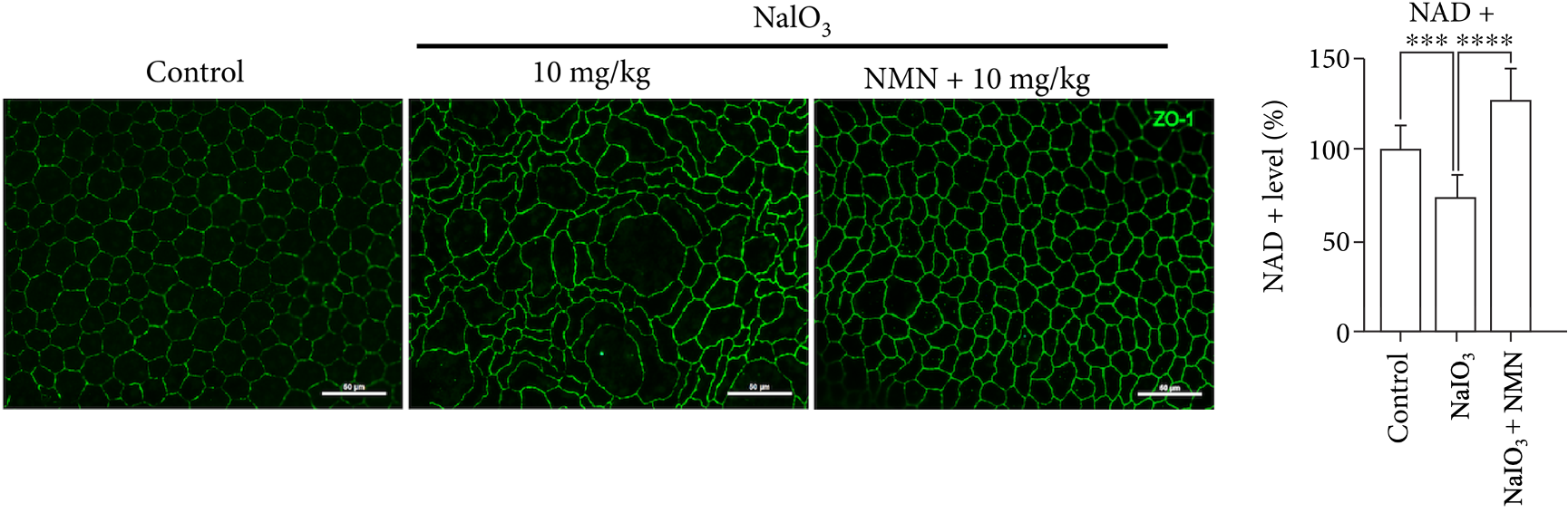 Scientists Show NMN Amends Eye Degeneration by Reducing Senescent Cells