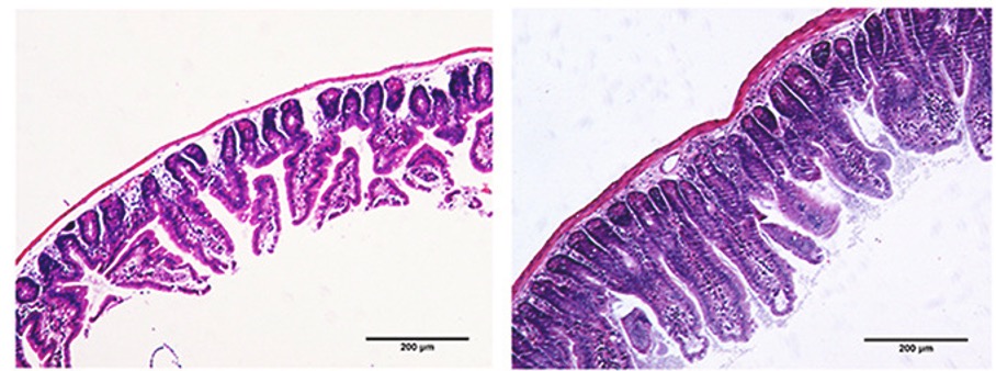 Study Finds NMN Protects Intestinal Wall from Cancer Radiation Therapy ...