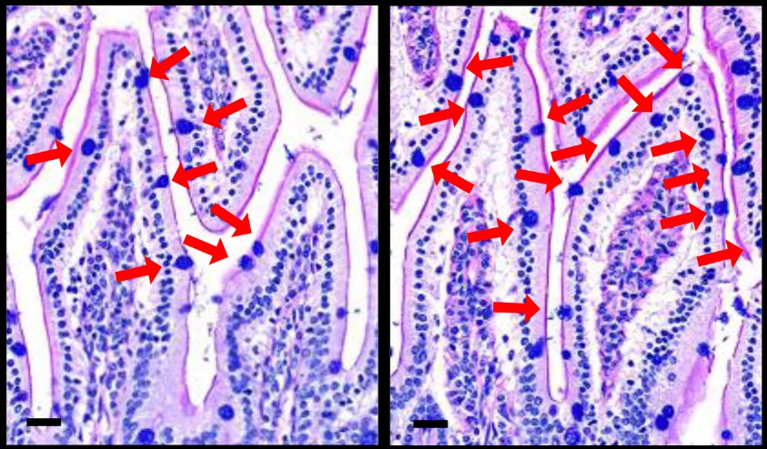 Scientists Find “Young” Gut Bacteria Revamp Immune Cells and Fortify ...