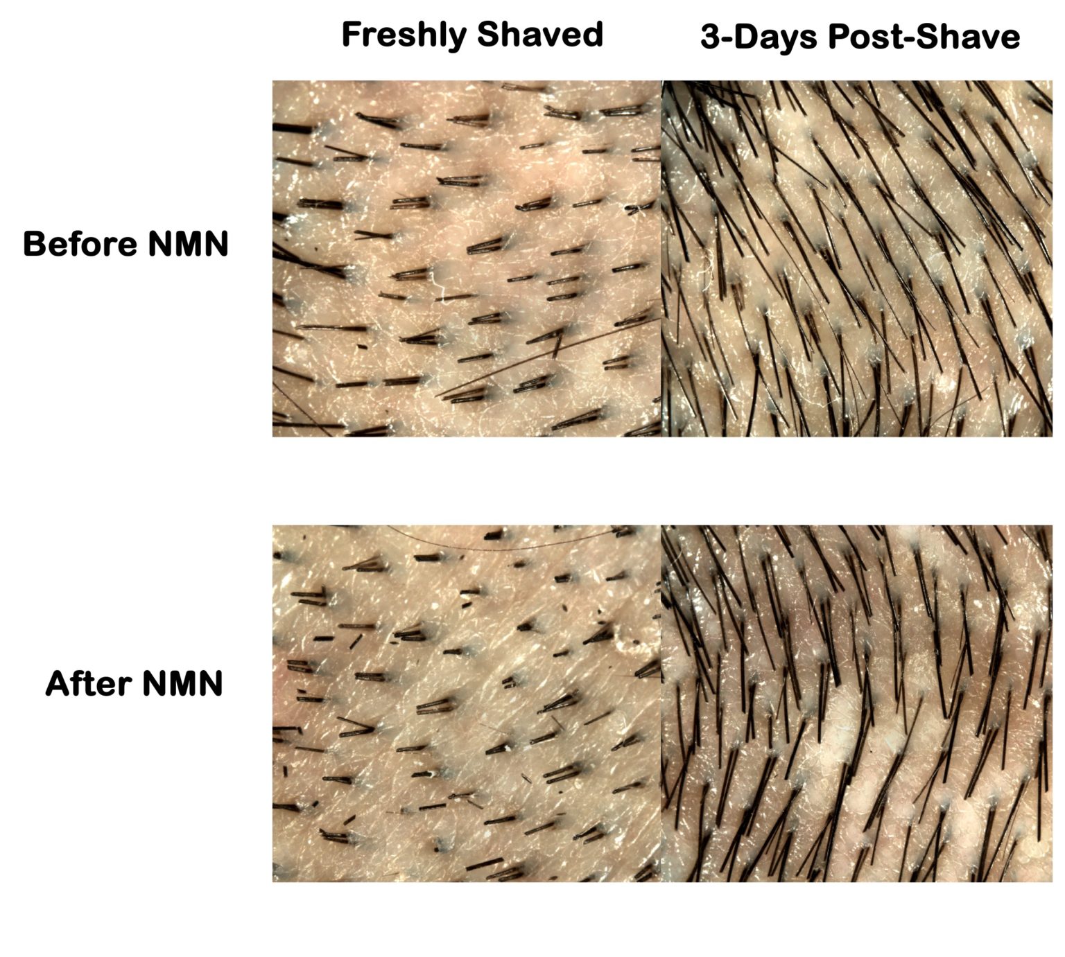 Anti-Aging Supplement NMN Reverses Hair Thinning in Middle-Aged Adults